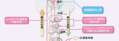 トラムセット® | 持田製薬株式会社